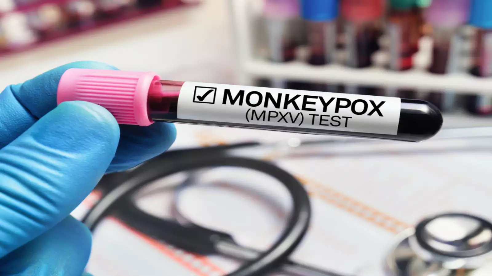 Azerbaijan detects first mpox case - AL24 News